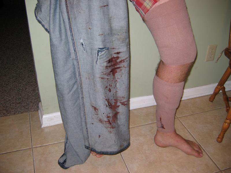 bobcat attack people